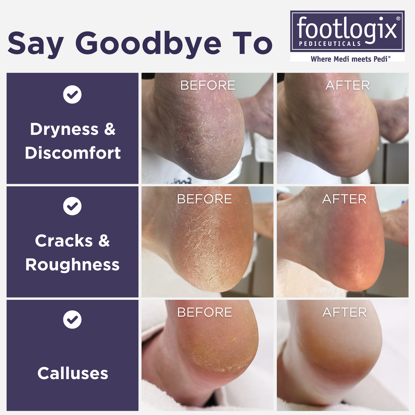 Transform Your Feet! - Footlogix Professional Grade Foot Care Products ...